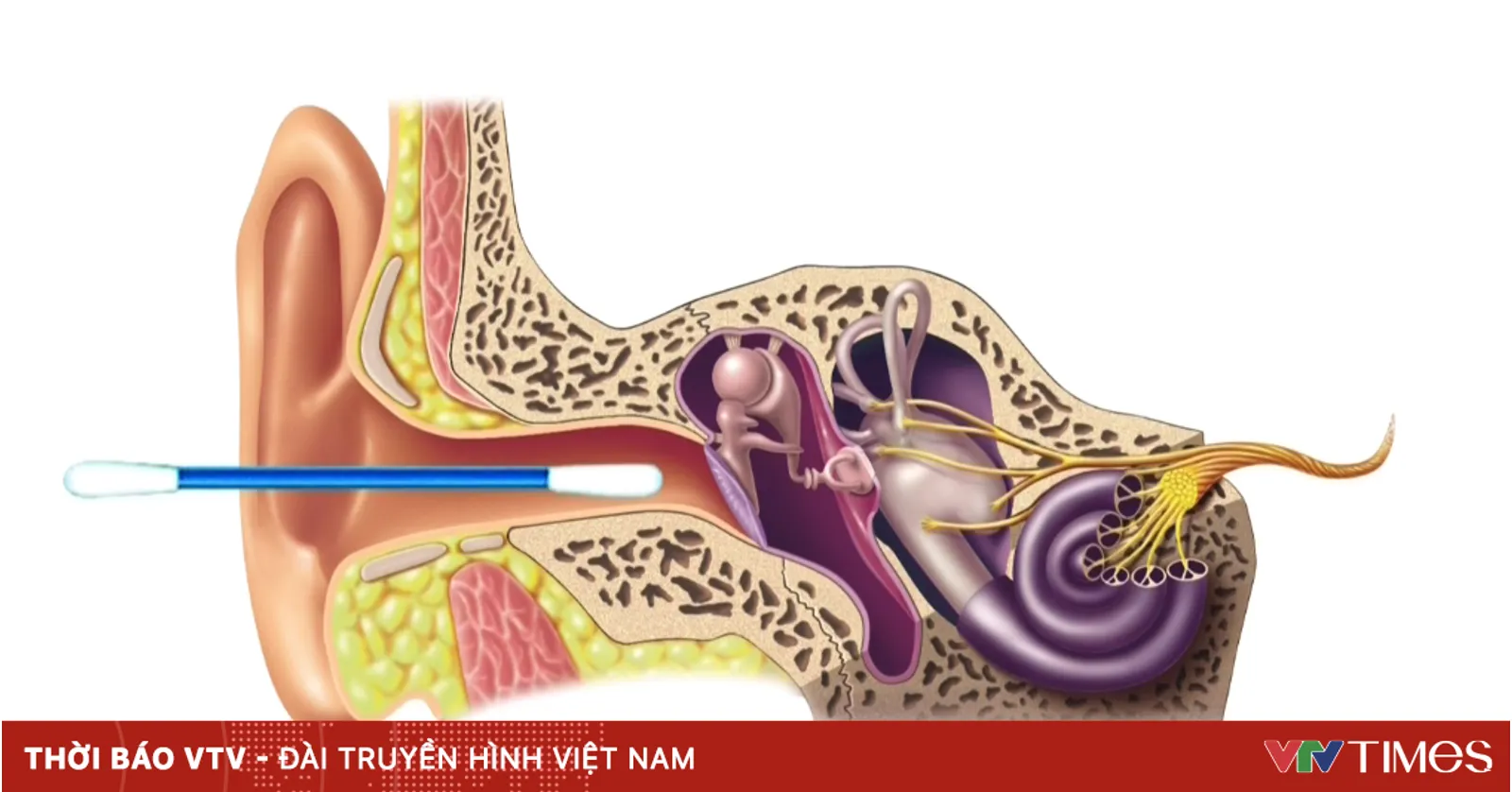 Nhập viện vì lấy ráy tai không đúng cách