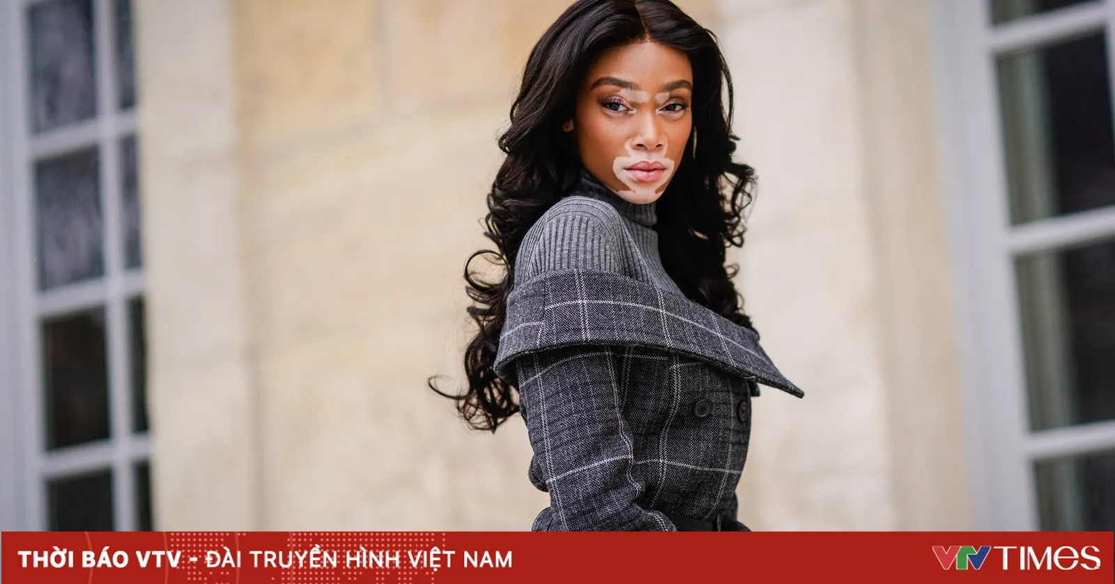 Người mẫu bạch biến lần đầu tham gia show diễn thời trang Victoria’s Secret