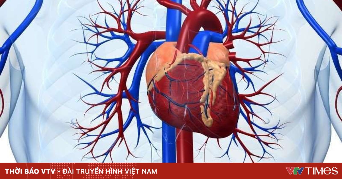 Viêm cơ tim cấp - Một số điều bệnh nhân cần biết